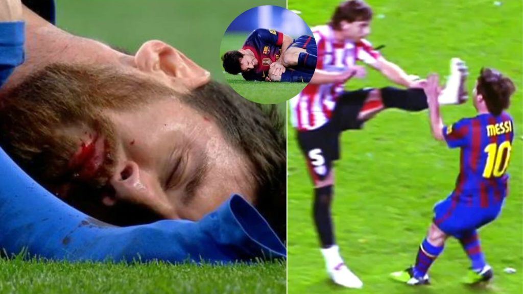 Players Hunting on Lionel Messi Horror Tackles Brutal - Lionel Messi